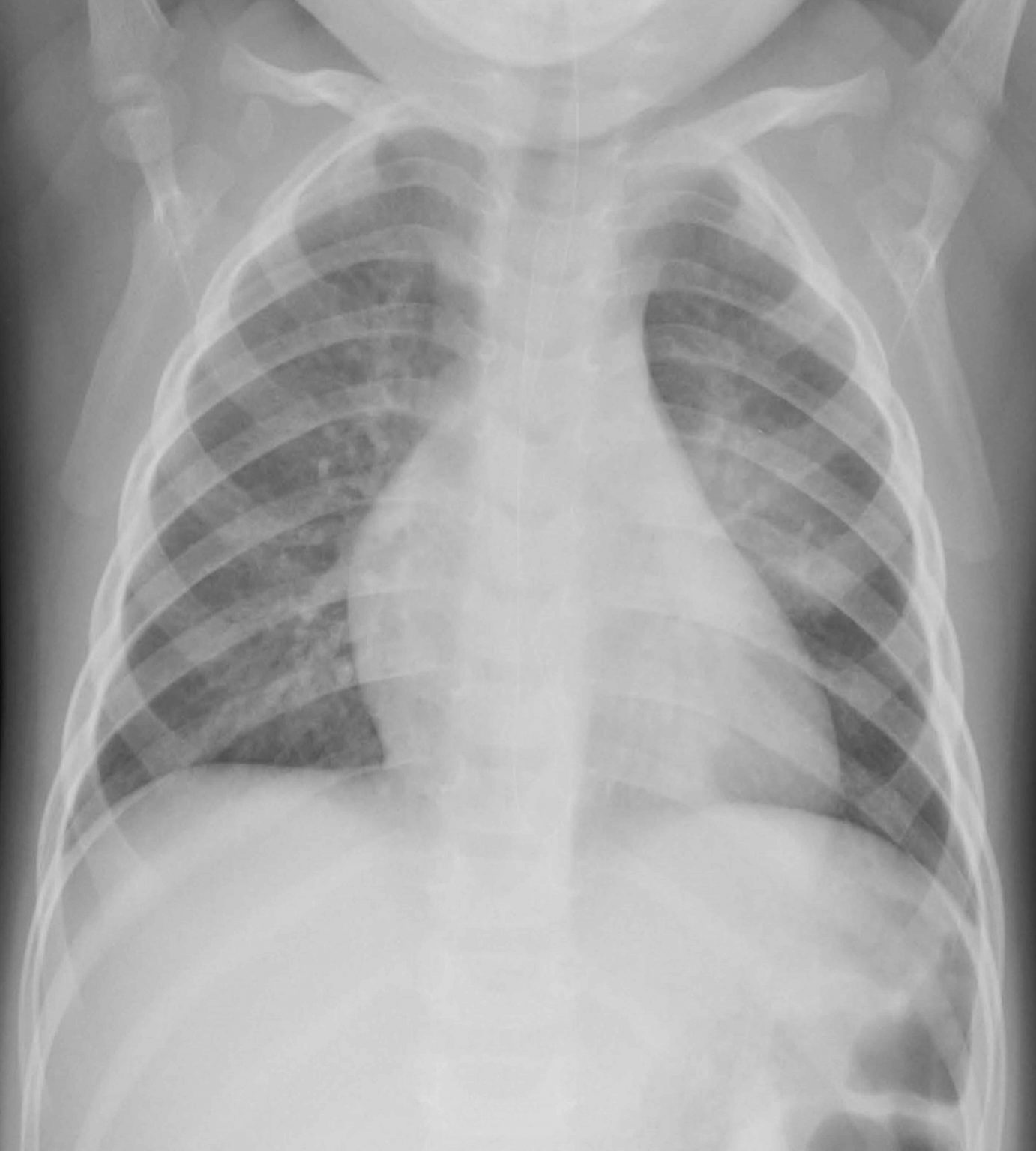 Consolidation - The Union