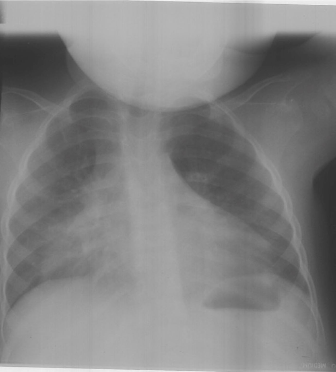 CXR Image Repository - The Union